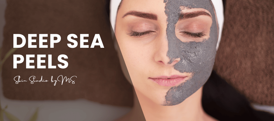 Deep Sea Peels – SkinStudiobyMS