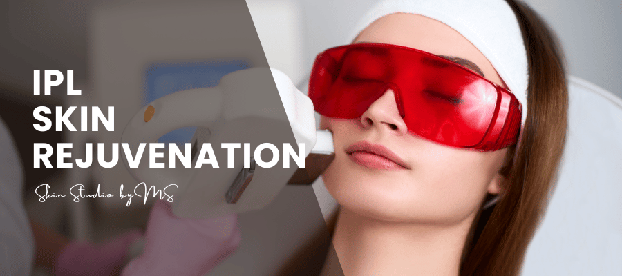 IPL Skin Rejuvenations – SkinStudiobyMS