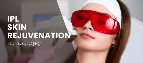IPL Skin Rejuvenations – SkinStudiobyMS