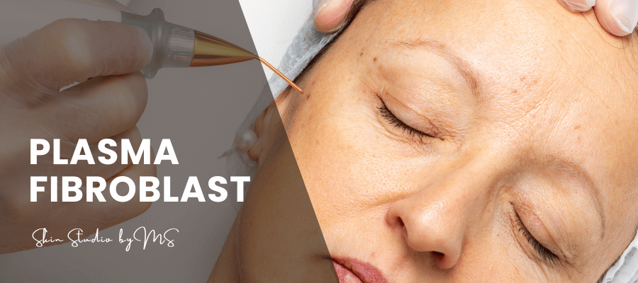 Plasma Fibroblast – SkinStudiobyMS