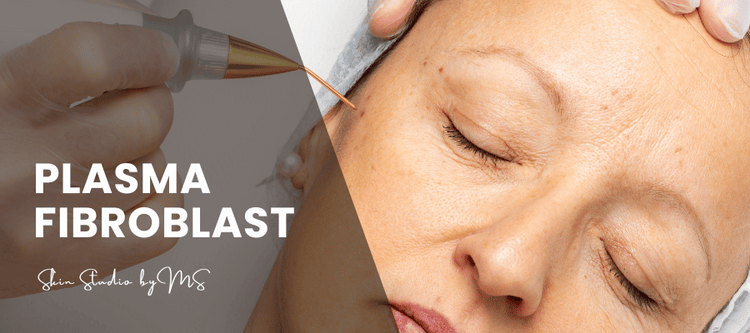 Plasma Fibroblast – SkinStudiobyMS